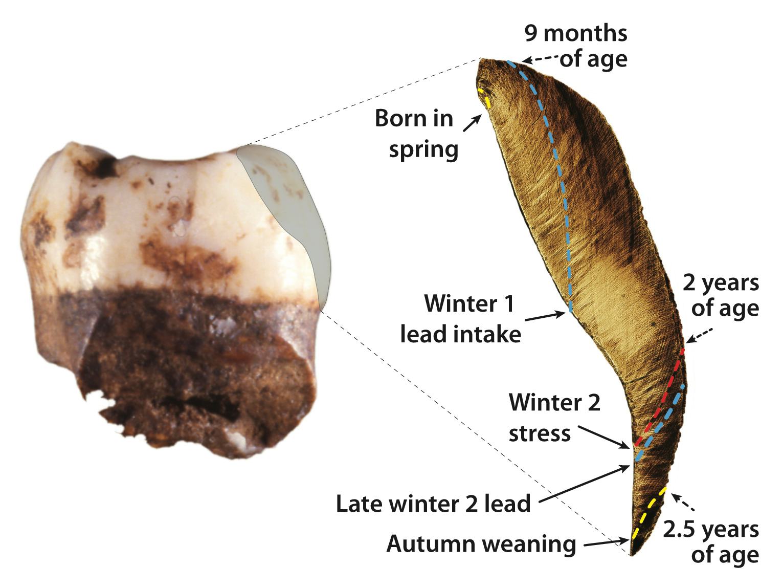 Neanderthals: "Tree Rings" in Juvenile Teeth Reveal Cold, Harsh Existence