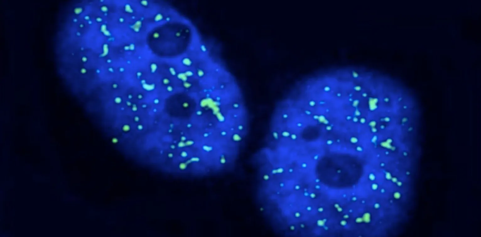 DNA Twisted Into a Never-Before-Seen Shape in a Living Cell: The i-Motif