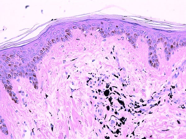 A Dermatologist Busts the Myths and Misconceptions About Tattoos