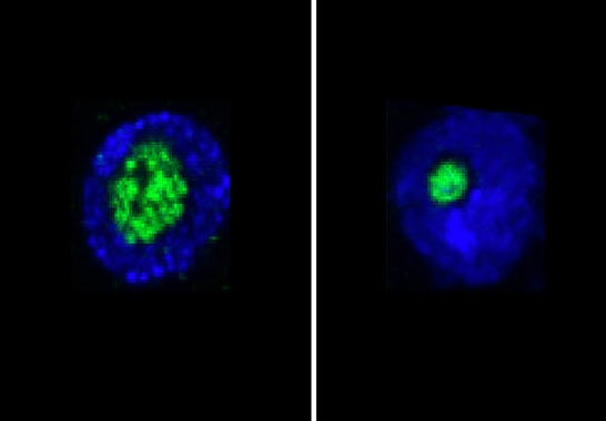 Anti-Aging: Lifespan May Be Determined by the Size of a Tiny Part of ...