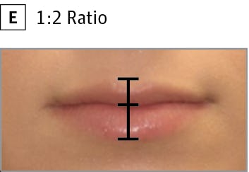 Scientists Determined What the Ultimate Attractive Lips Look Like