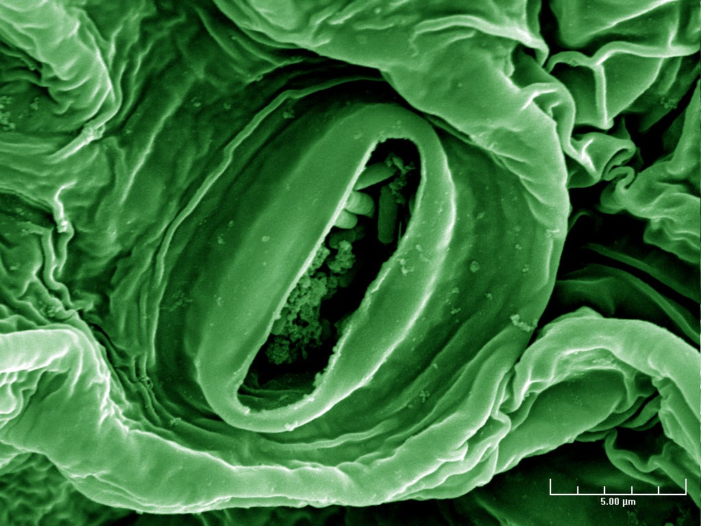 E. Coli Symptoms From Romaine Lettuce: What Does Food Poisoning Feel Like?