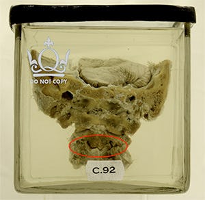 Pathologist Carla Valentine Will Ease Your Fear of Death