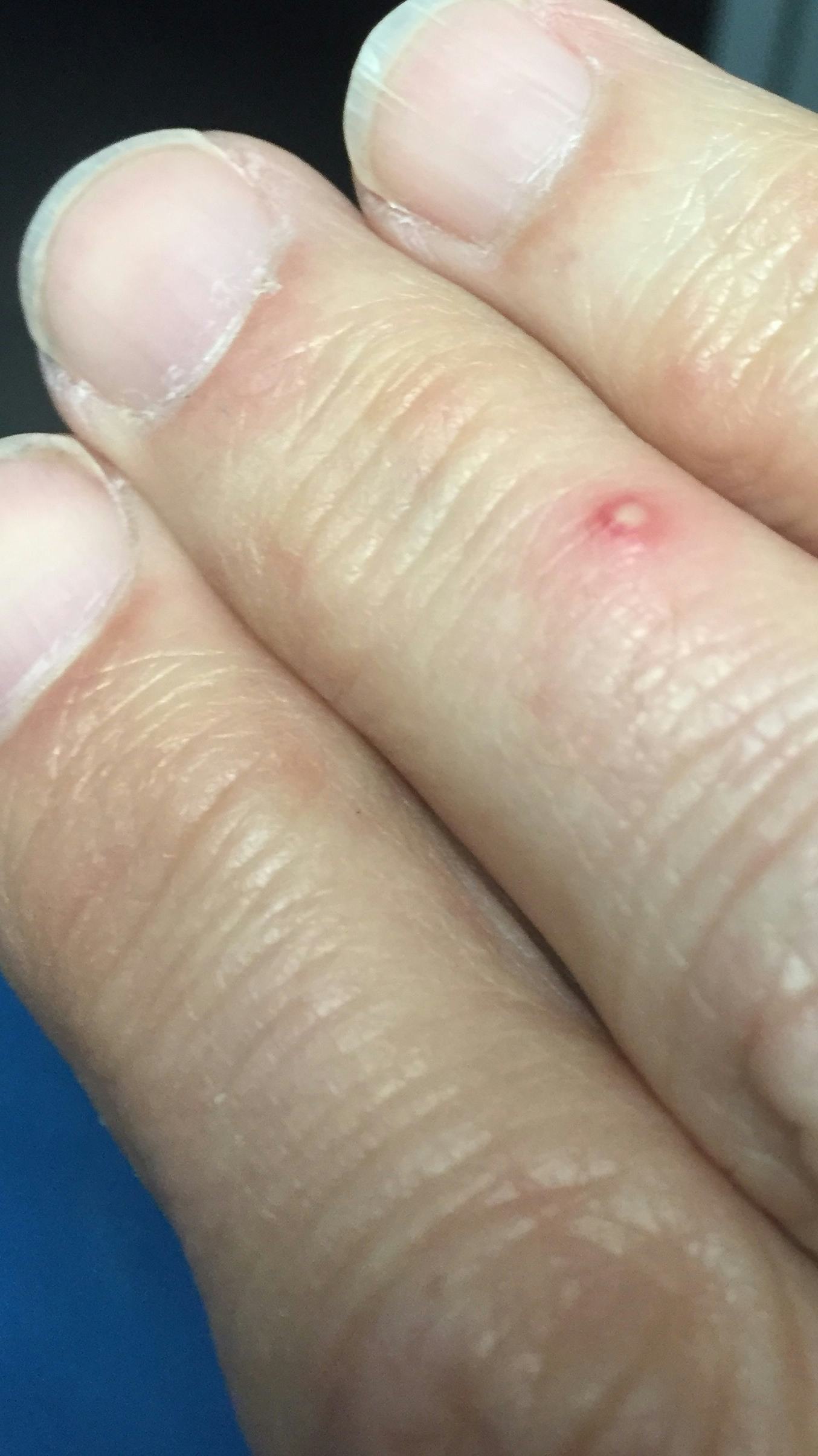 How the Houston Flood Supercharged This Raft of Fire Ants