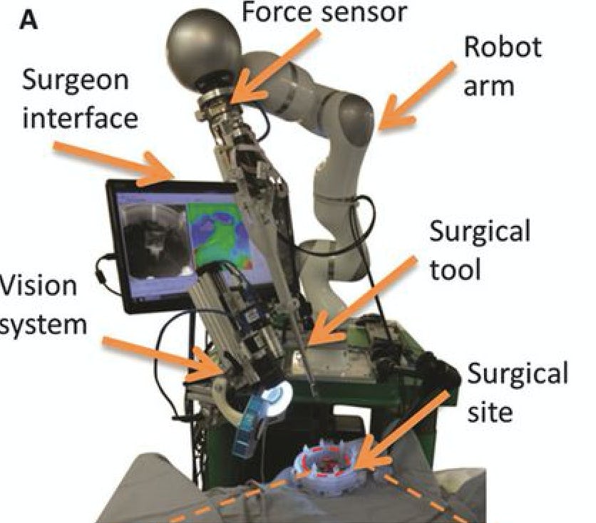 The Smart Tissue Autonomous Robot Can Perform Surgery Without Doctors The Smart Tissue Autonomous Robot Can Perform Surgery Without Doctors