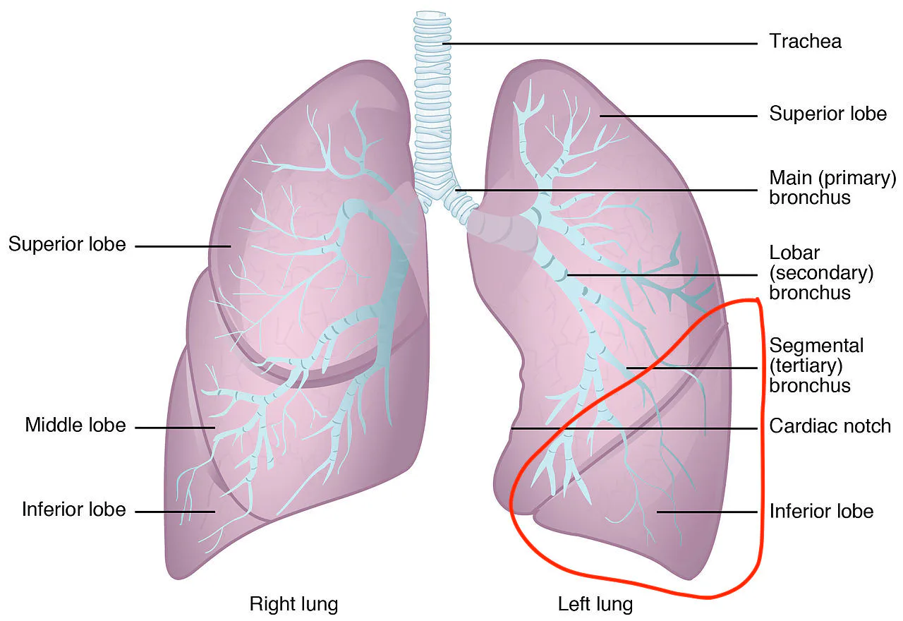 Pulmonary Lobectomy: Ruth Bader Ginsburg's Surgery, Explained