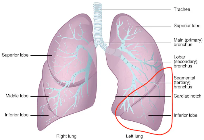 Pulmonary Lobectomy: Ruth Bader Ginsburg's Surgery, Explained