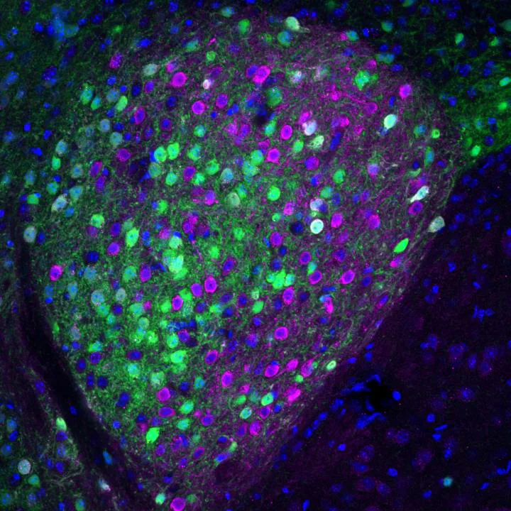 Why Do We Overeat? Newly Found Brain Circuit Drives Our Love of Tasty Food