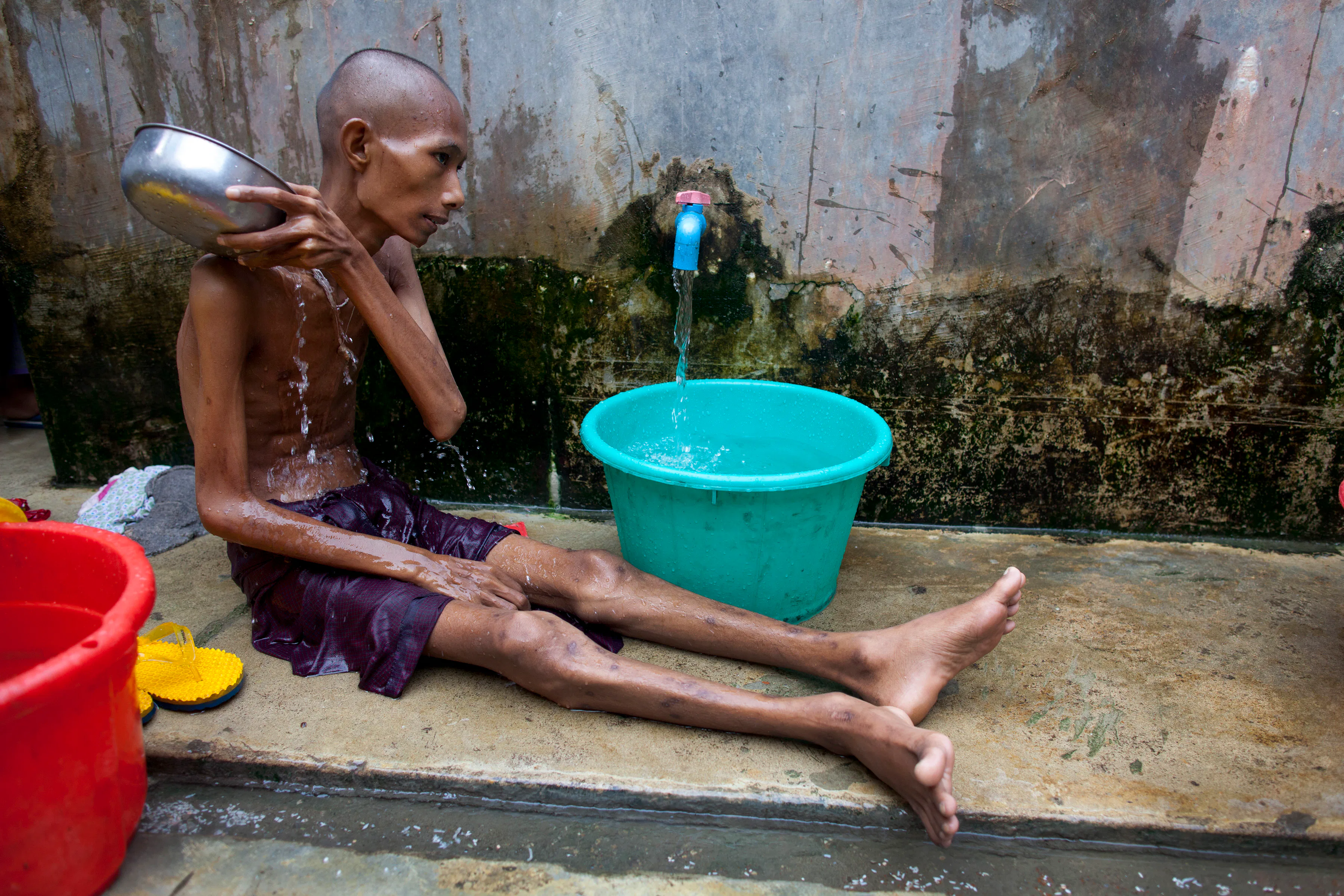 An HIV Vaccine Will Arrive By 2030, Says Bill Gates, & We Sure Hope He ...