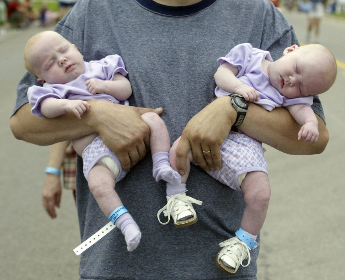 What's It Like To Be An Identical Twin? 45 Things Only We Twins Understand