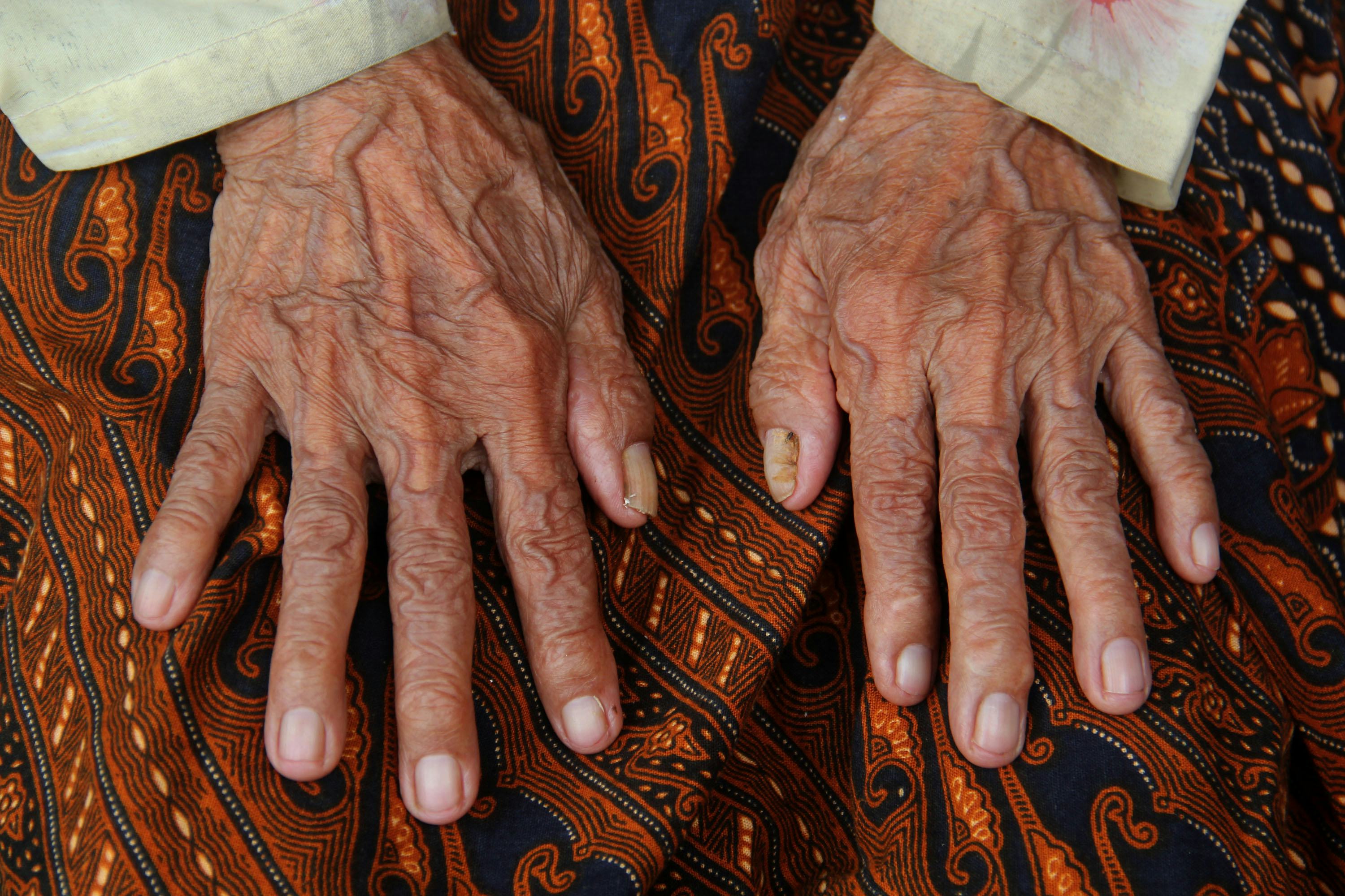 Using Nutmeg For Hair & Skin Woes Suddenly Changed My Summer Beauty ...