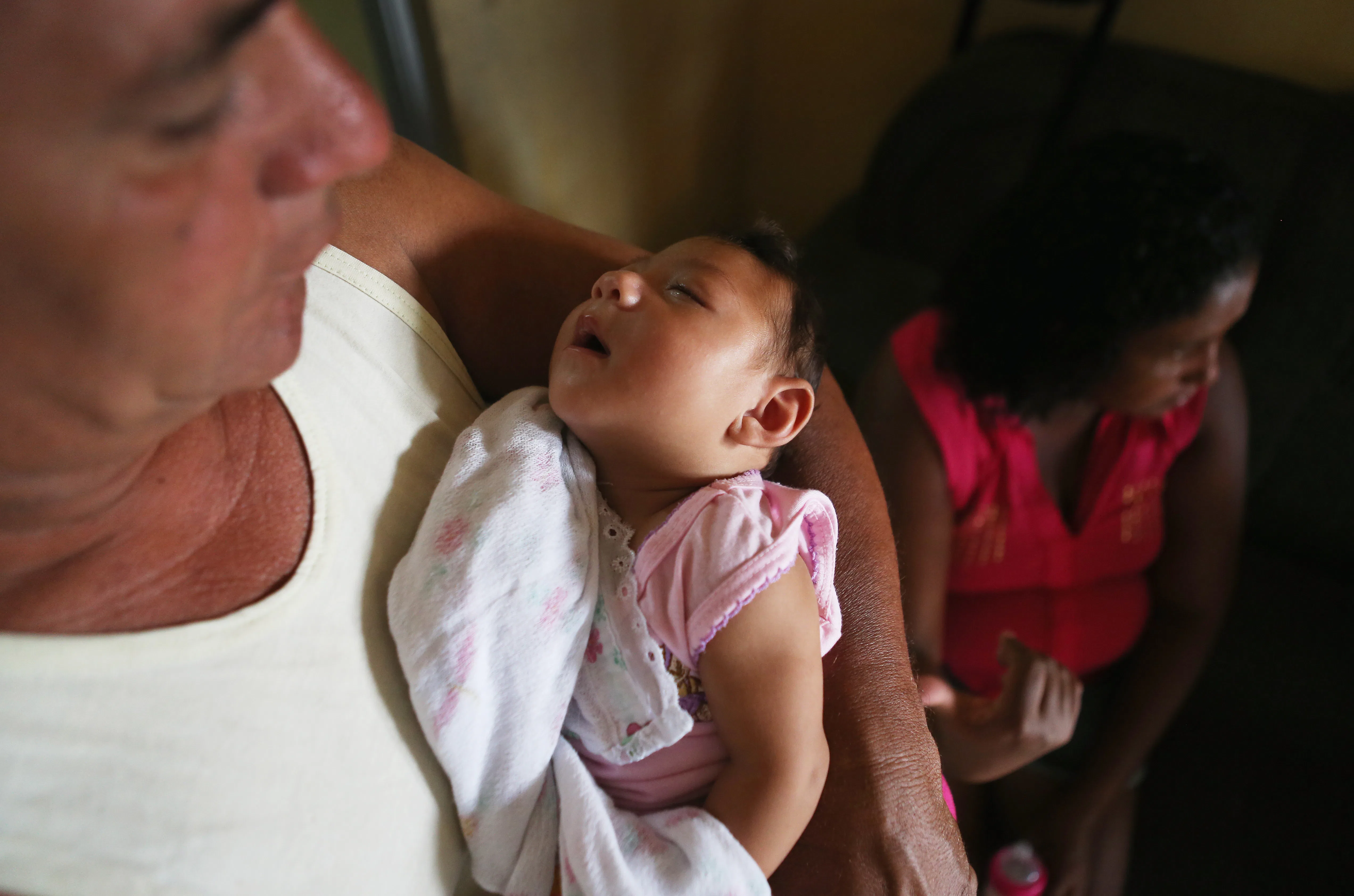 What Is Microcephaly? The Zika Virus Can Lead To This Rare Condition