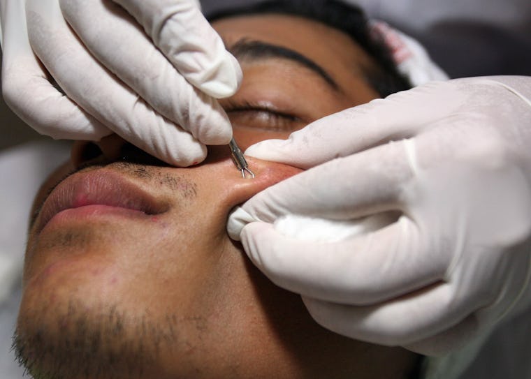 6 Types Of Pimples & What They Mean About Your Skin According To A ...