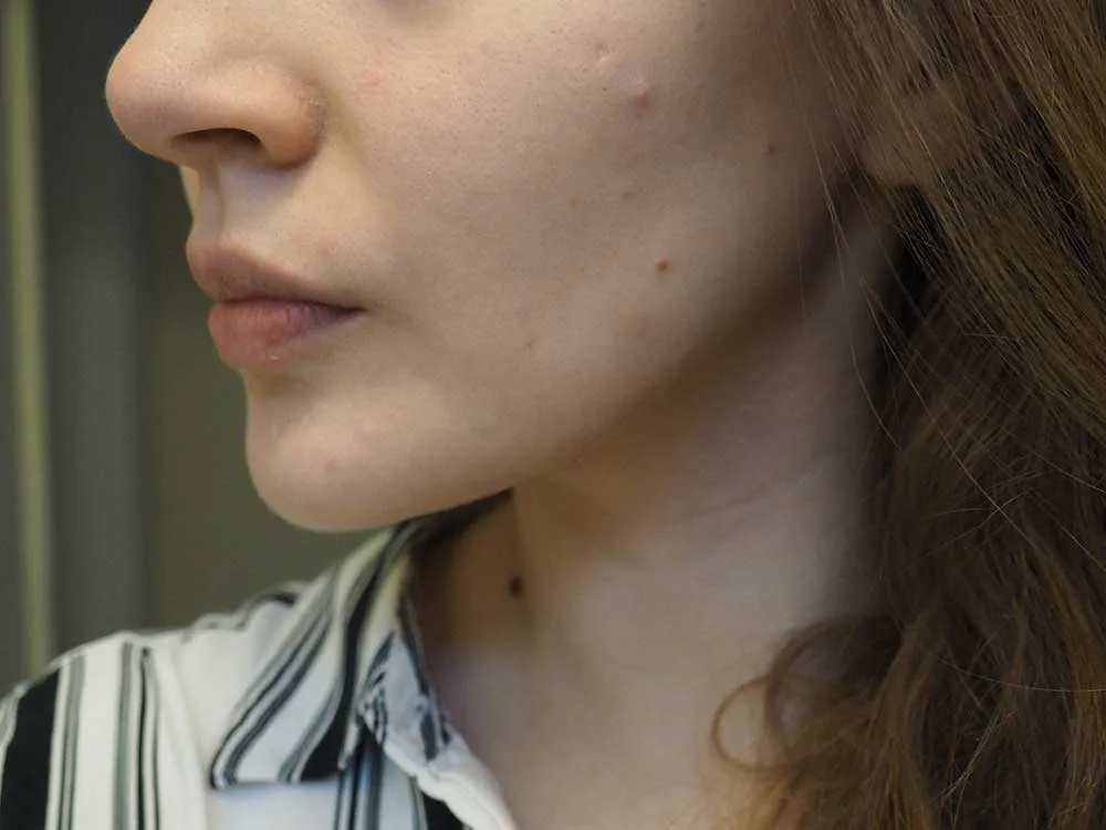 I Rubbed Strawberries On My Face For A Week To Look Like Marilyn Monroe ...