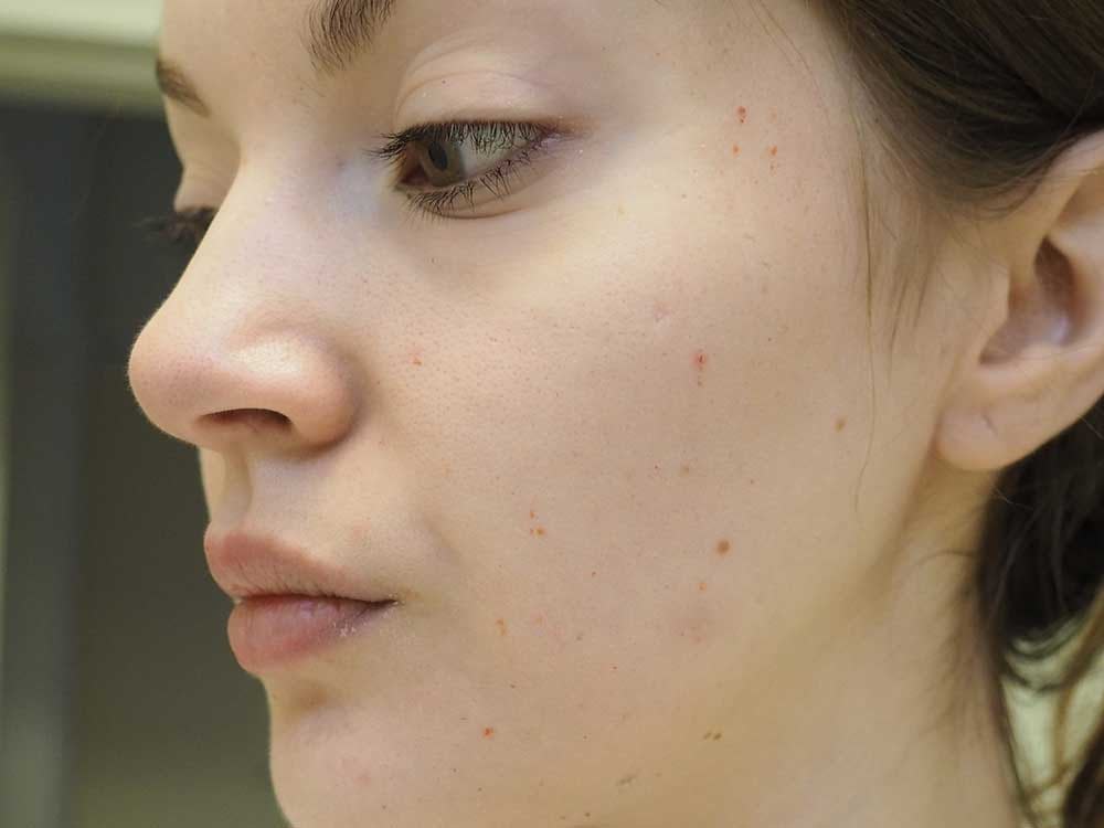 I Rubbed Strawberries On My Face For A Week To Look Like Marilyn Monroe ...