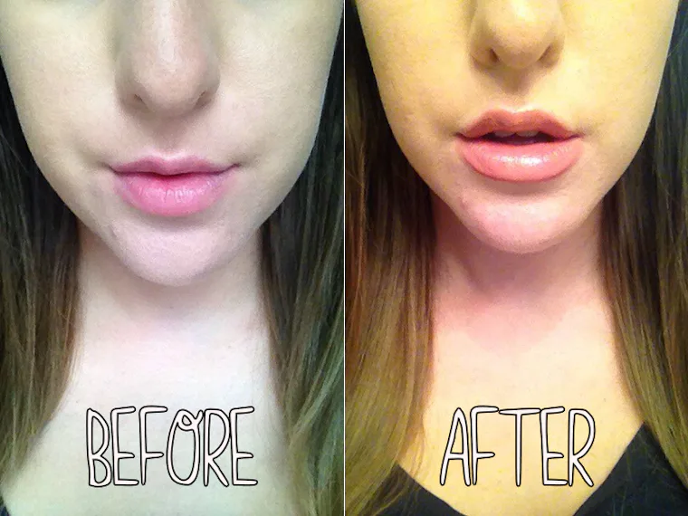 A Kylie Jenner Lip Tutorial For Thin Lips That Doesn't Involve Sucking ...