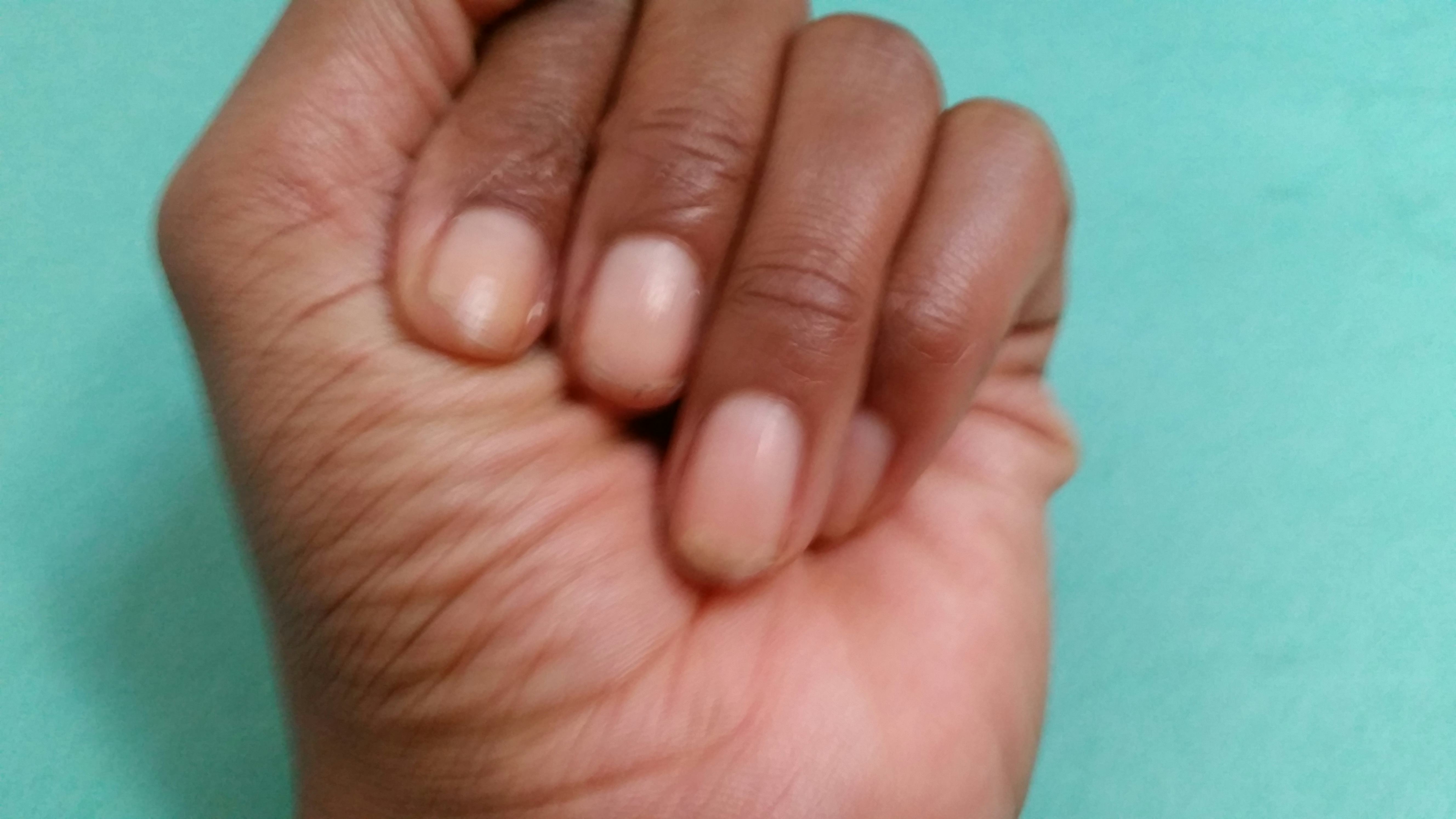 How I Stopped My Nails From Splitting & Breaking All The Time