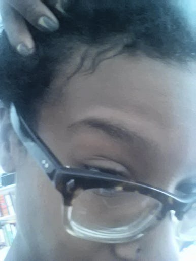 Learn How To Stop Hair Breakage At The Roots By Avoiding These 7 ...