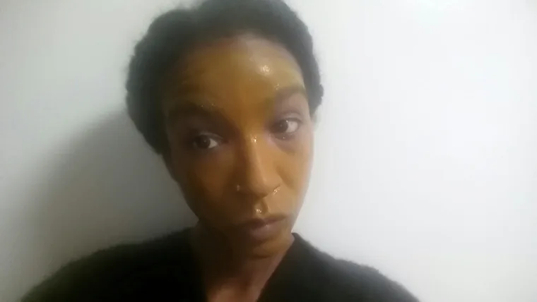 How To Use Gram Flour & Chickpeas For Brightening, Acne Controlling Facials