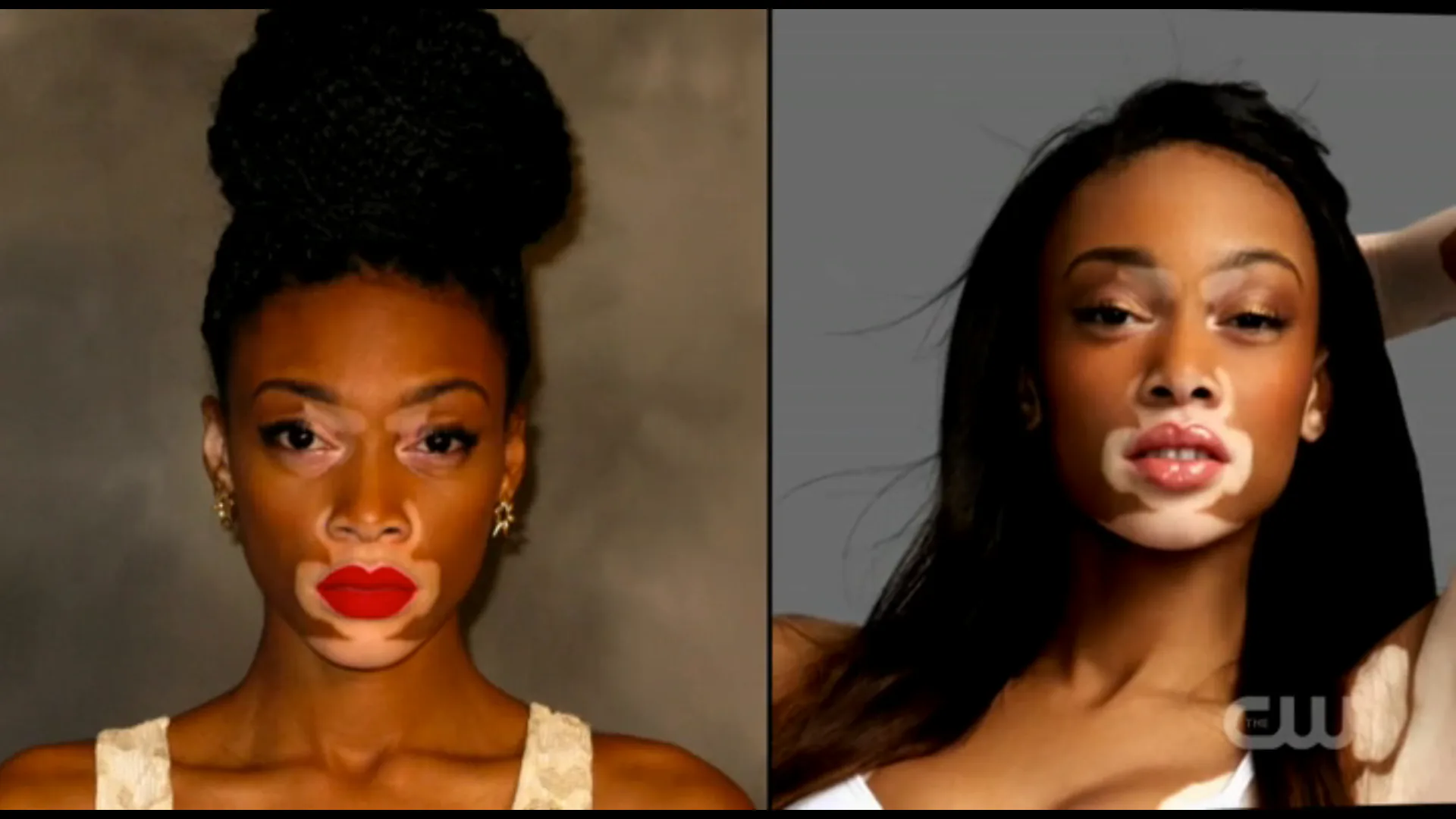 'ANTM' Cycle 21 Makeover Superlatives, With Beard Weaves And Two-Toned ...