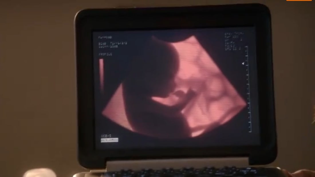 Is Halle Berry's 'Extant' Baby An Alien? That And 4 Other Huge Burning ...