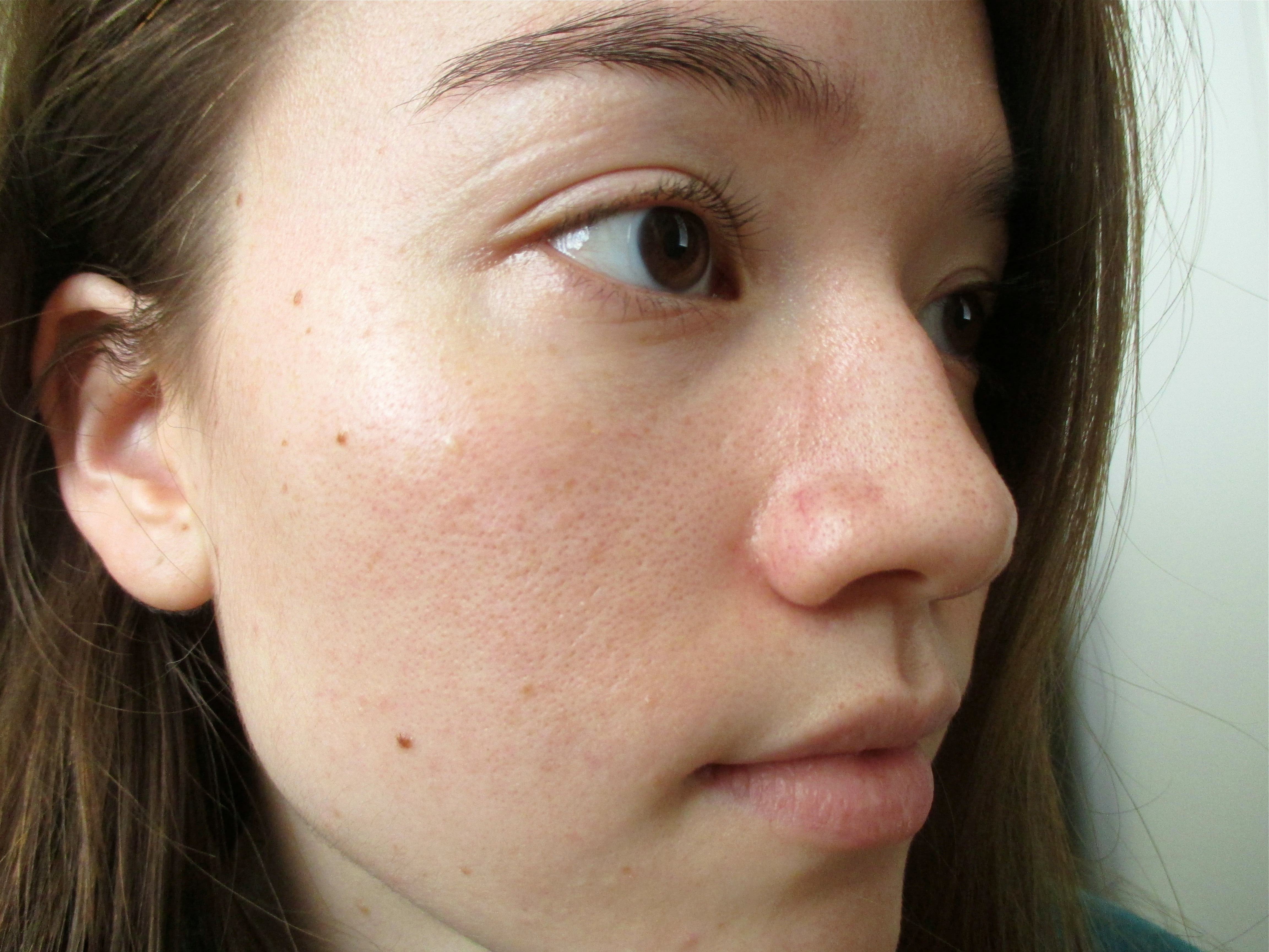 Does The Clarins Mission Perfection Serum Actually Even Skin Tone? I ...