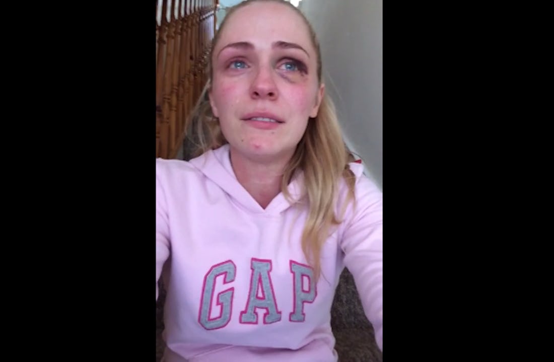 Fitness Blogger Emma Murphy Opened Up About Domestic Violence In A ...