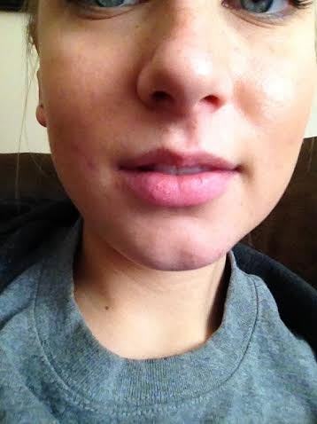 I Tried Bite 5 Night Fix For Lips — And Will Never Go Back to My Old ...