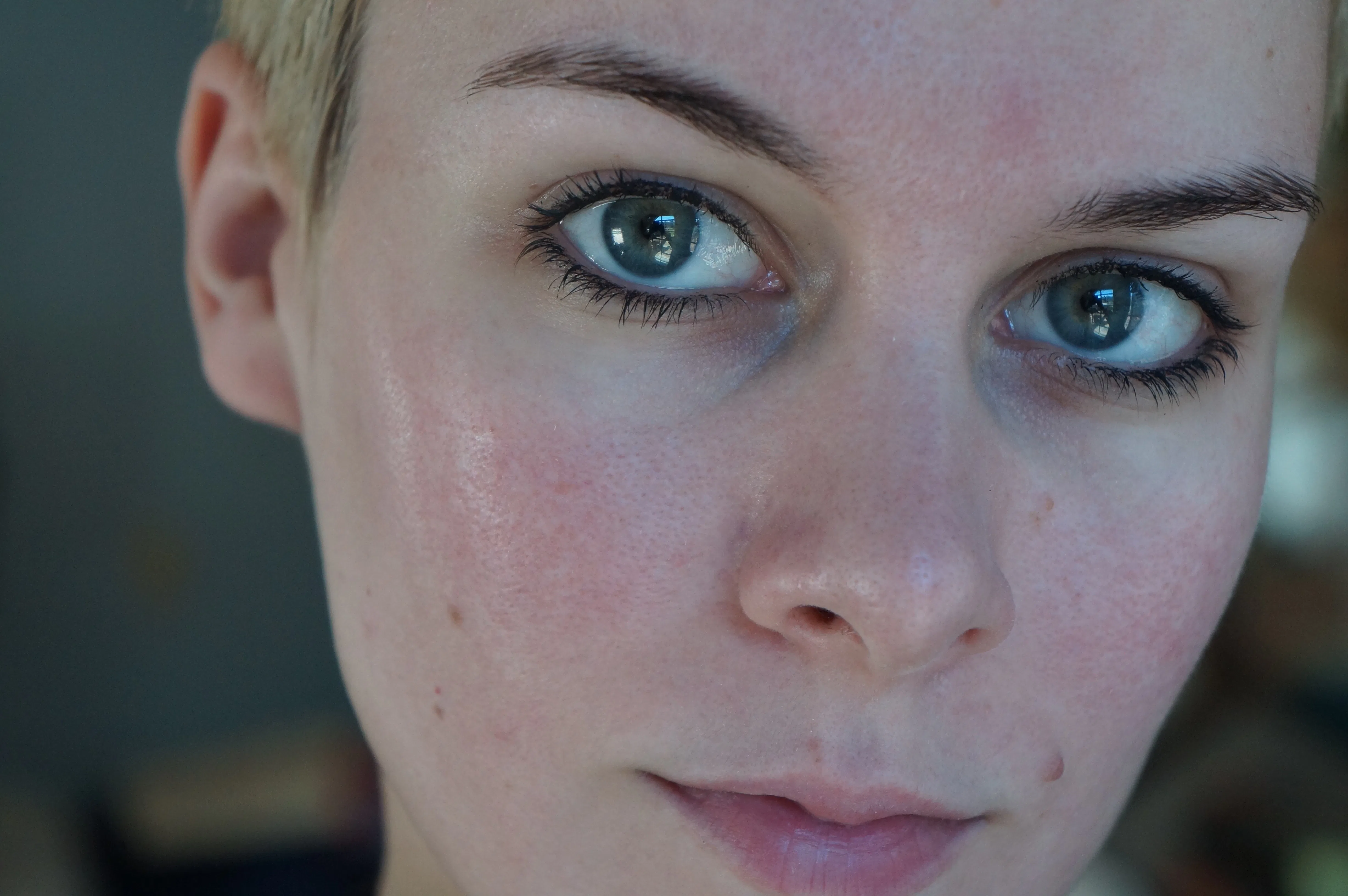 I Tried Adding Sulfur To My Skin Care Routine To Reduce The Redness On ...