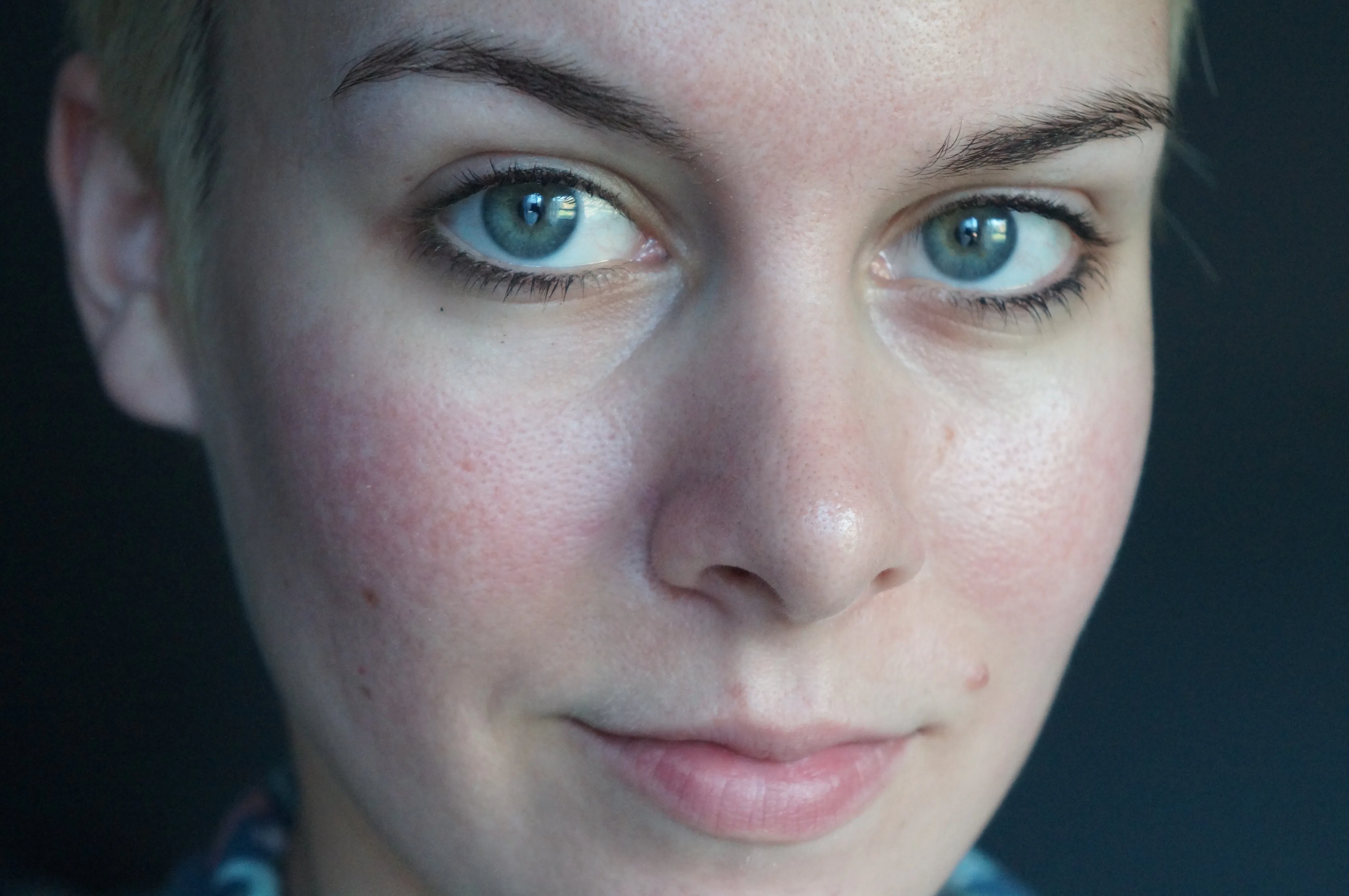 I Tried Adding Sulfur To My Skin Care Routine To Reduce The Redness On ...