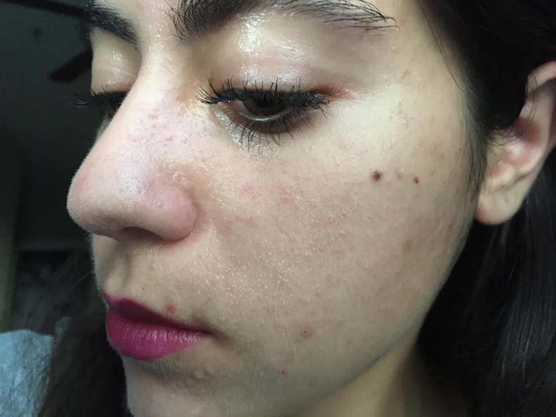 I Tried 6 Facial Sprays To Find Out Which Ones Are Most Refreshing