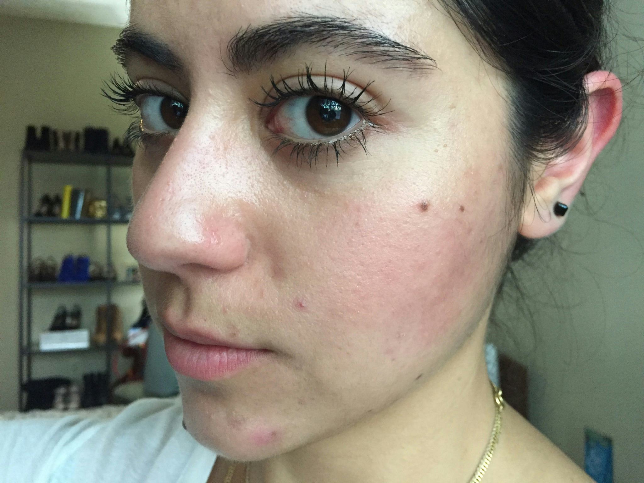 21 Things People With Oily Skin Are Sick Of Hearing