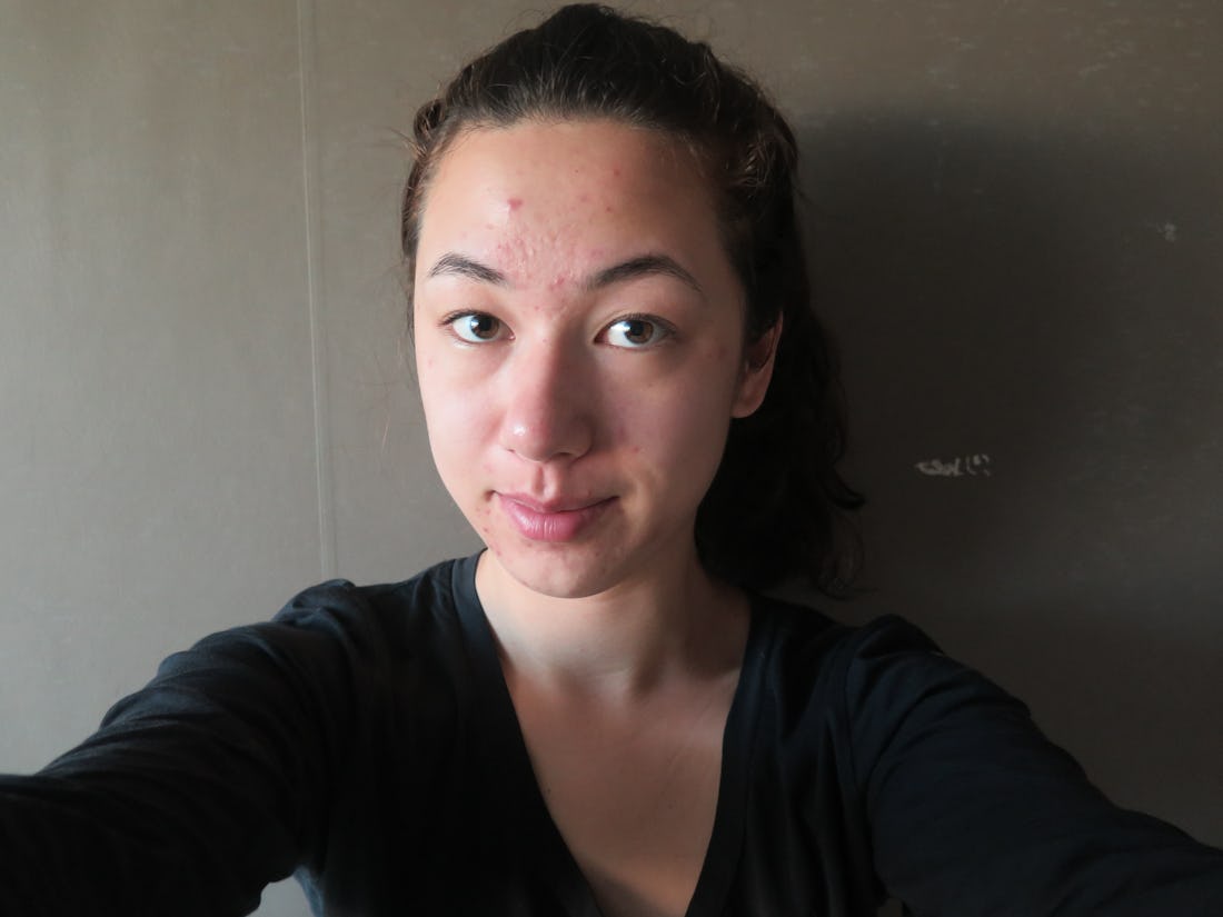 I Used Two Sheet Masks Every Day For A Week & This Is What Happened ...