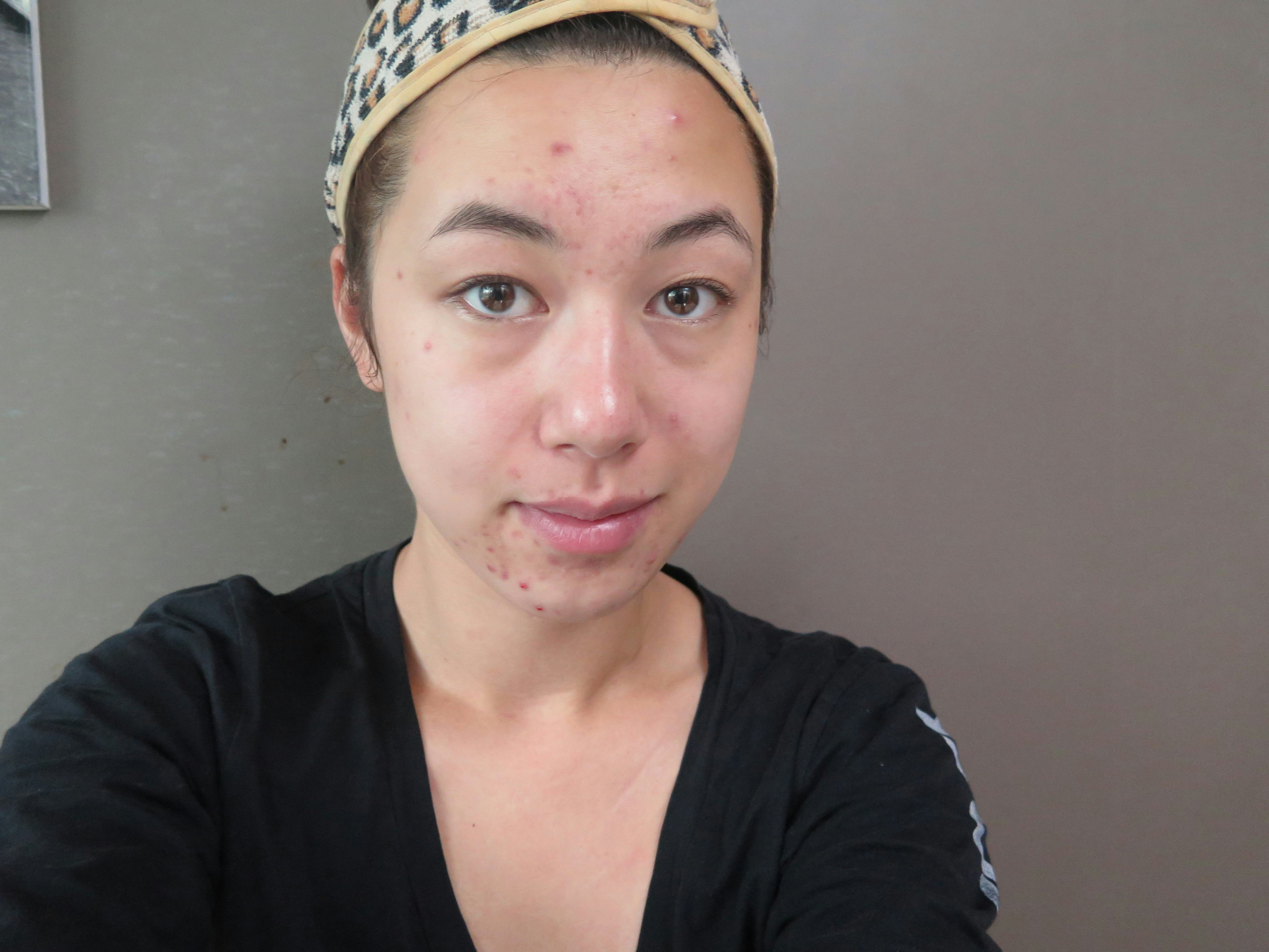 I Used Two Sheet Masks Every Day For A Week & This Is What Happened ...