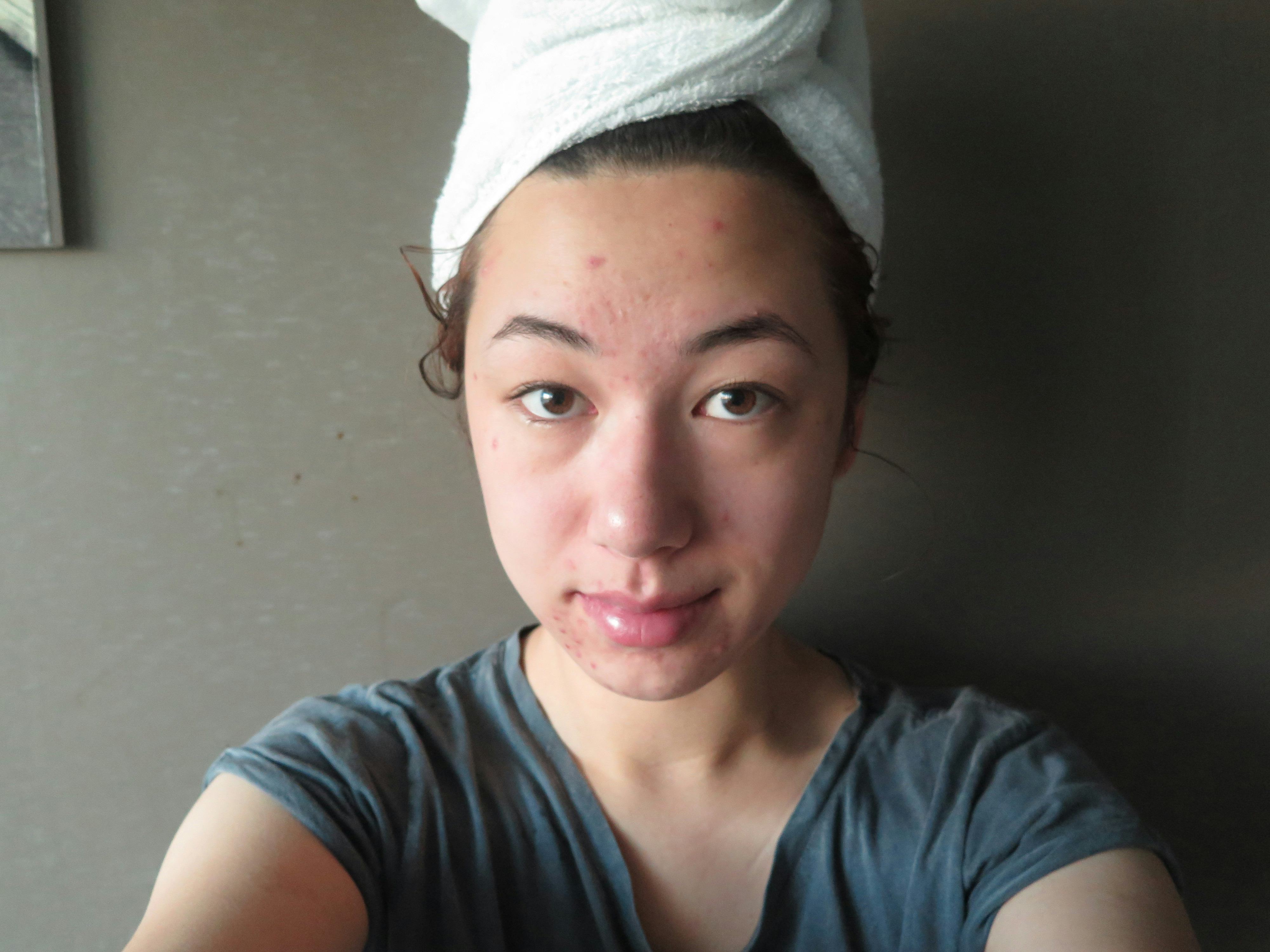 I Used Two Sheet Masks Every Day For A Week & This Is What Happened ...