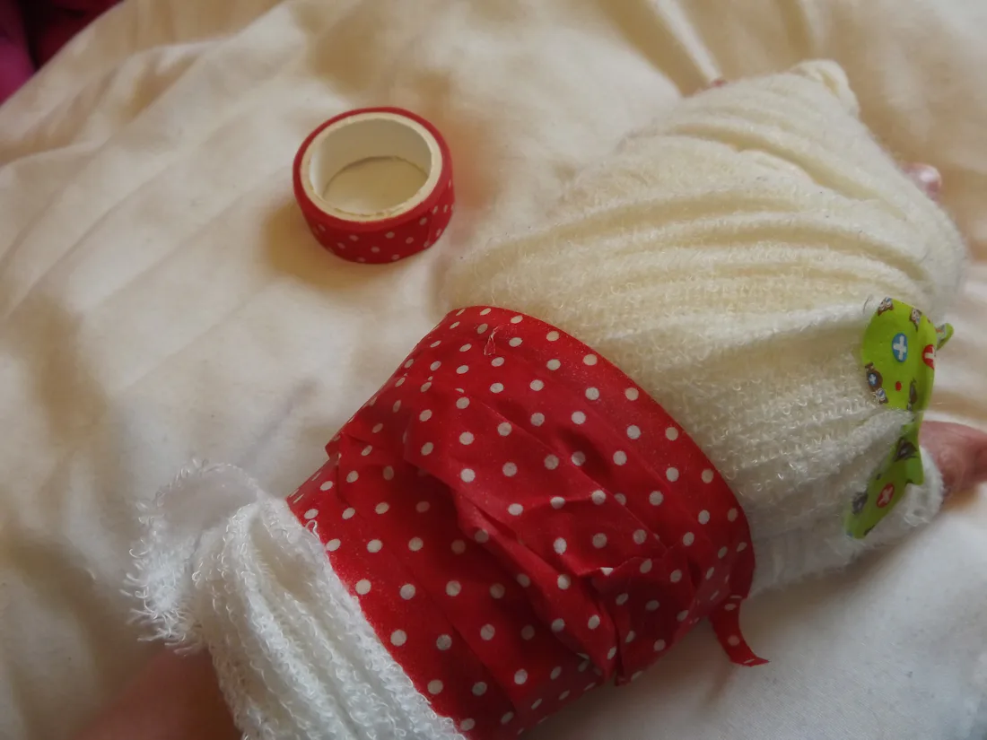 How I Turned My Minor Injury Into A Fashion Statement — Blinging Up My ...