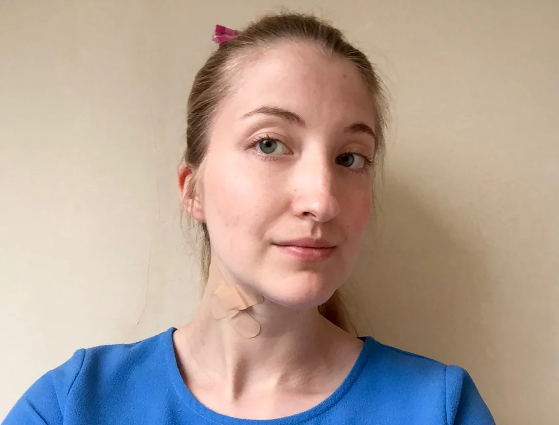 10 Ways To Cover A Hickey If You Don't Have Makeup