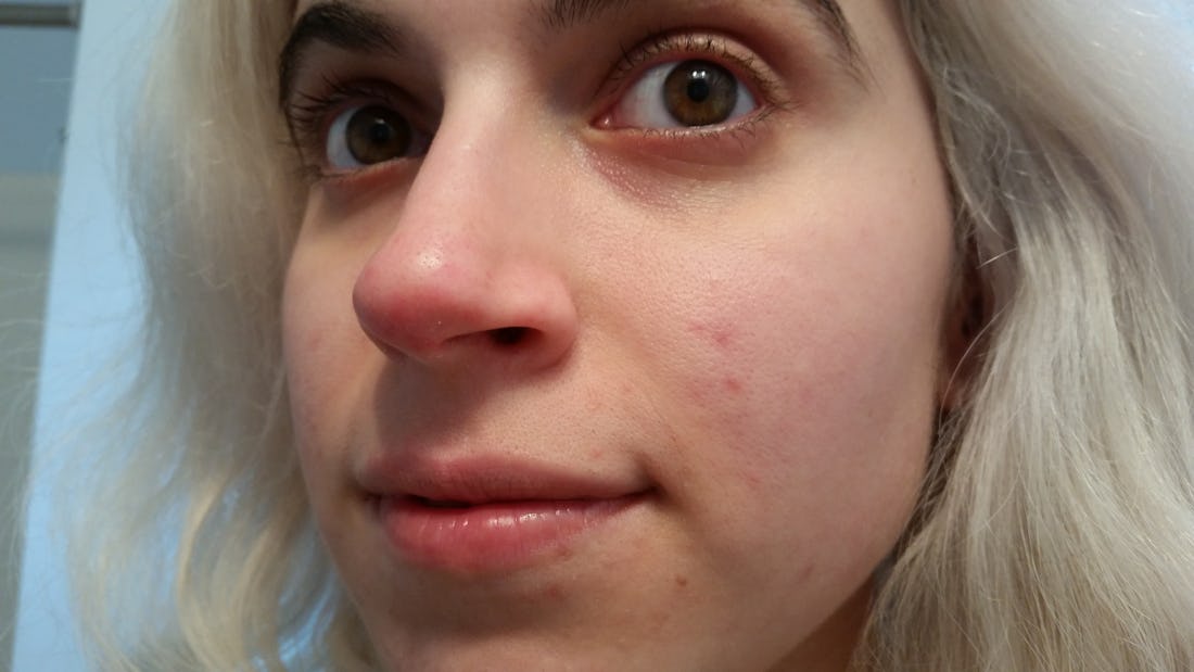 I Washed My Face With Rice Water For A Week & I Wish I'd Followed This ...