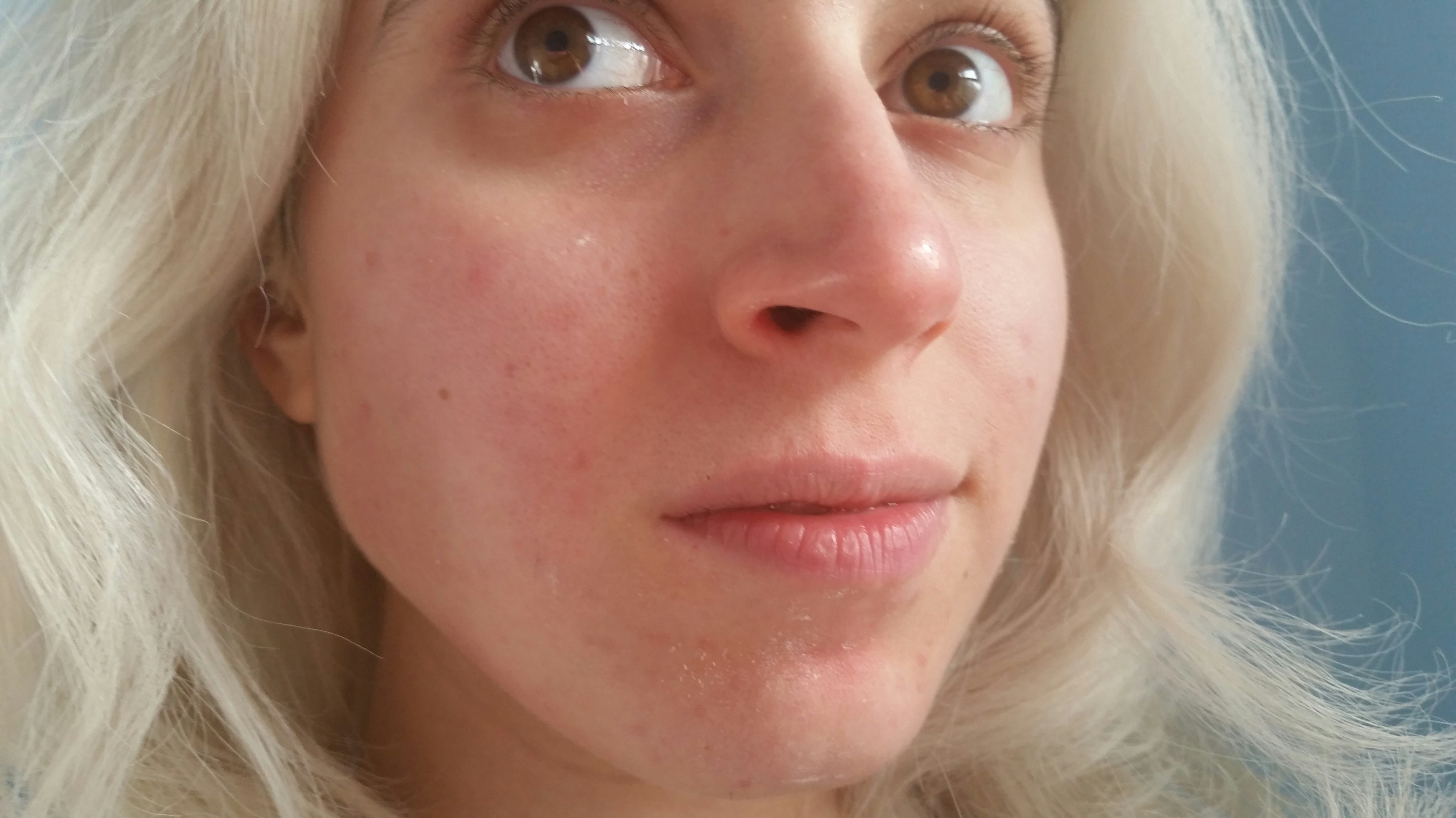 I Washed My Face With Rice Water For A Week & I Wish I'd Followed This ...