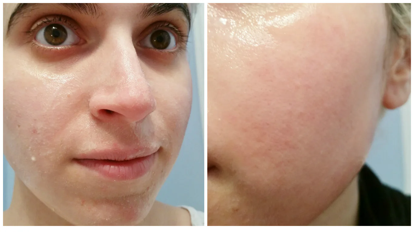 I Used Probiotics On My Skin For 4 Weeks Straight & Here's What ...