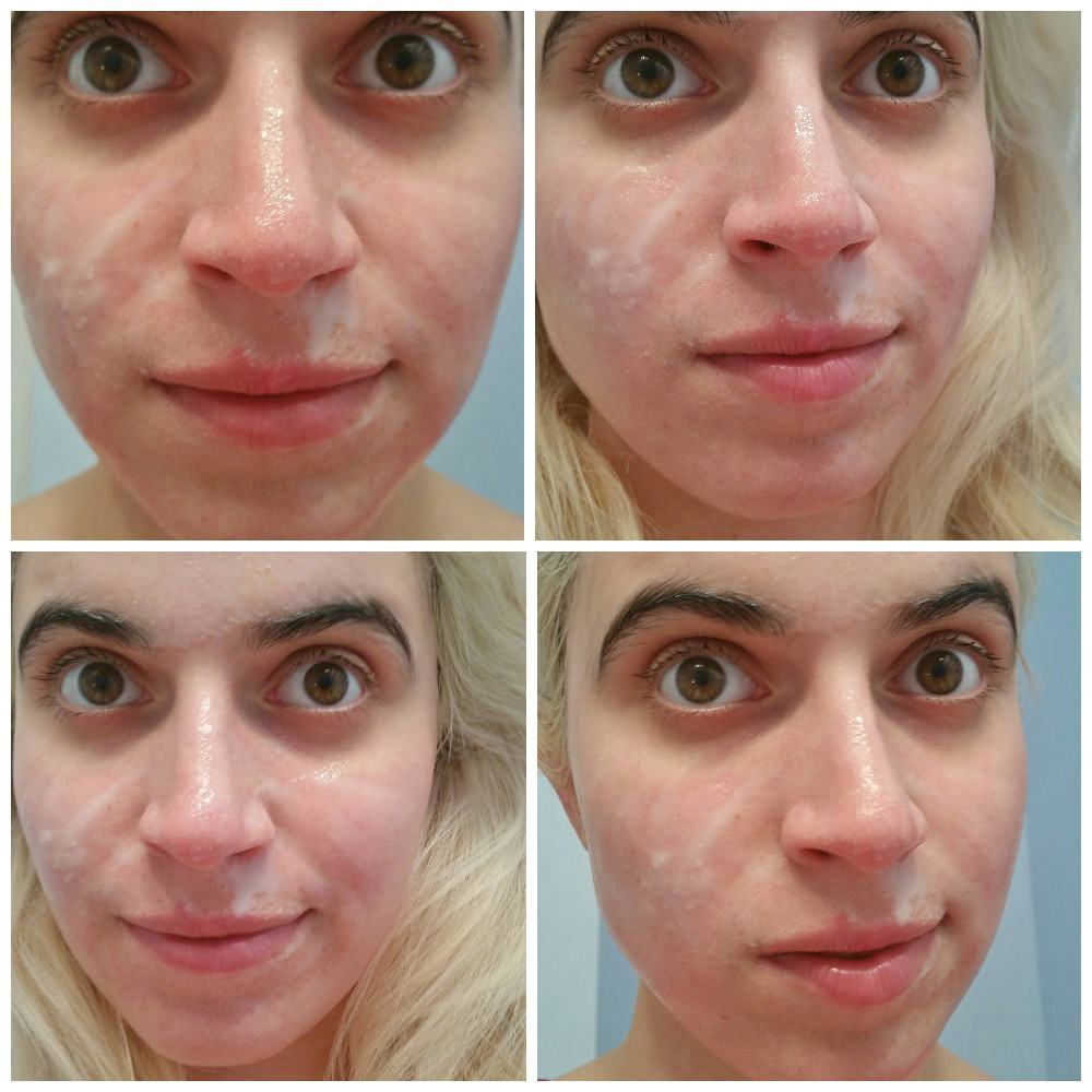 I Used Probiotics On My Skin For 4 Weeks Straight & Here's What ...