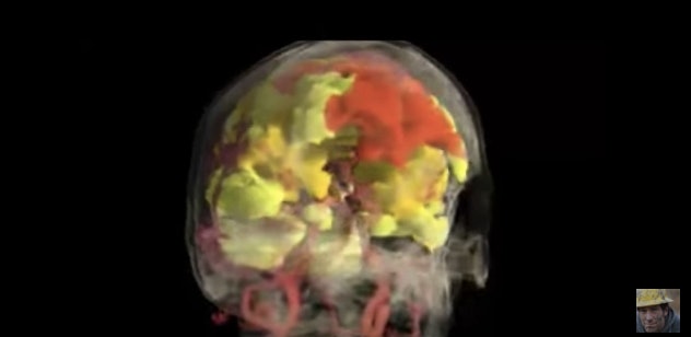 This Is What Happens To Your Brain When You Orgasm