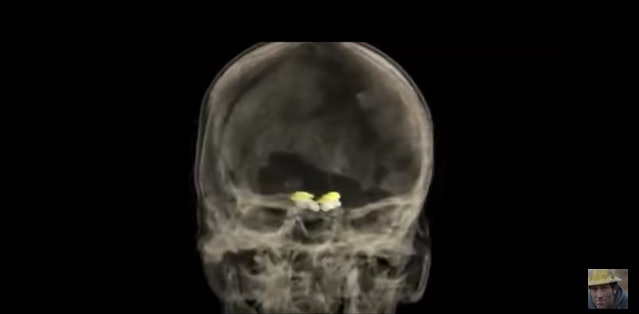 This Is What Happens To Your Brain When You Orgasm