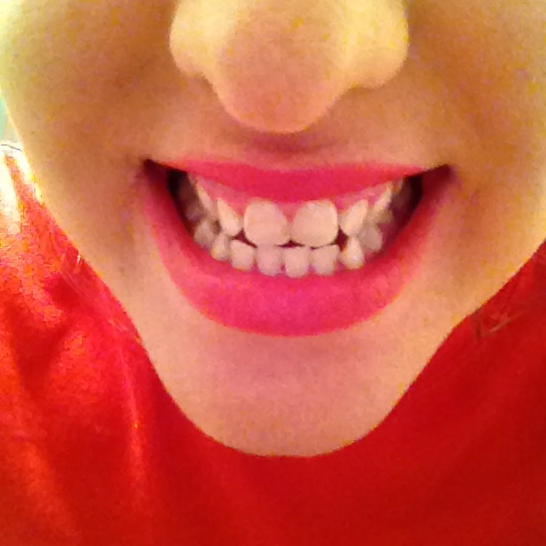 I Tried At-Home Teeth Whitening Methods Pinterest Recommends To Get A ...