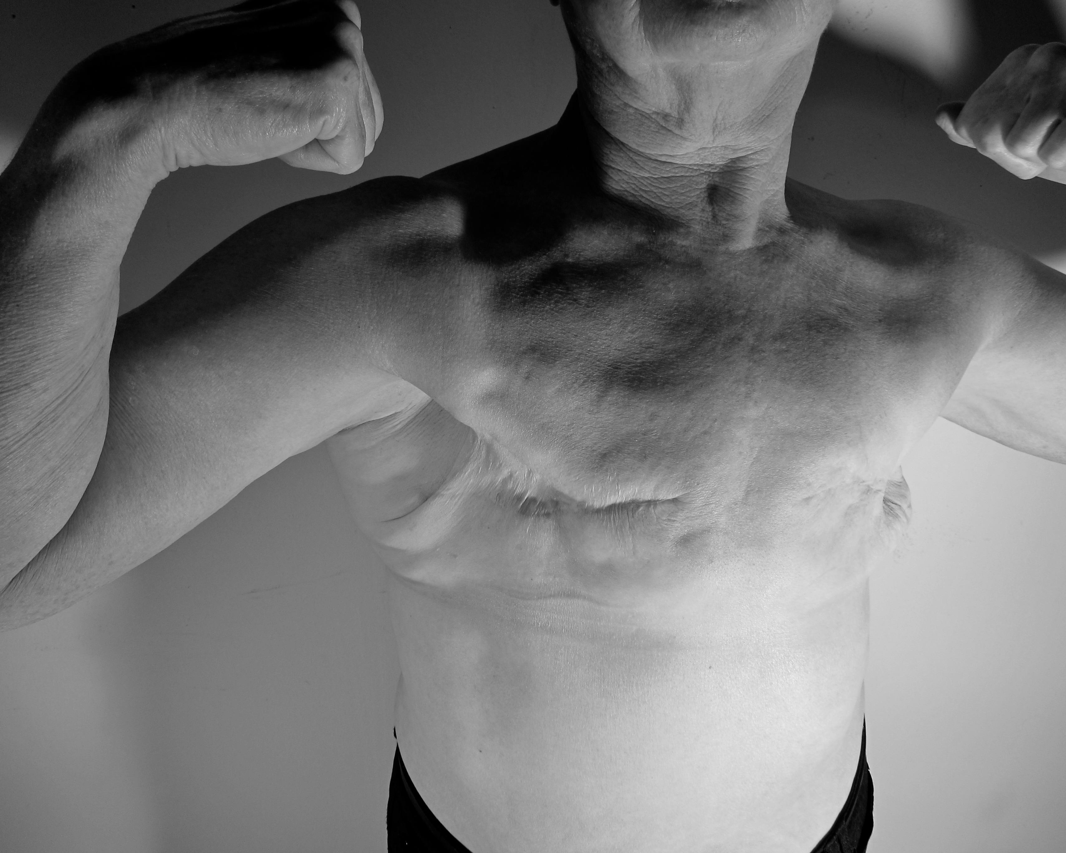 12 Powerful Photos Show Women's Bodies After Breast Cancer