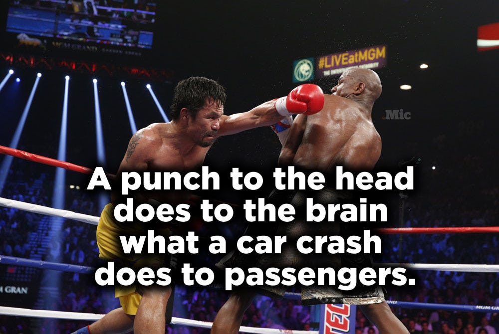 This Is What Happens to Your Brain When You Get Punched in the Head