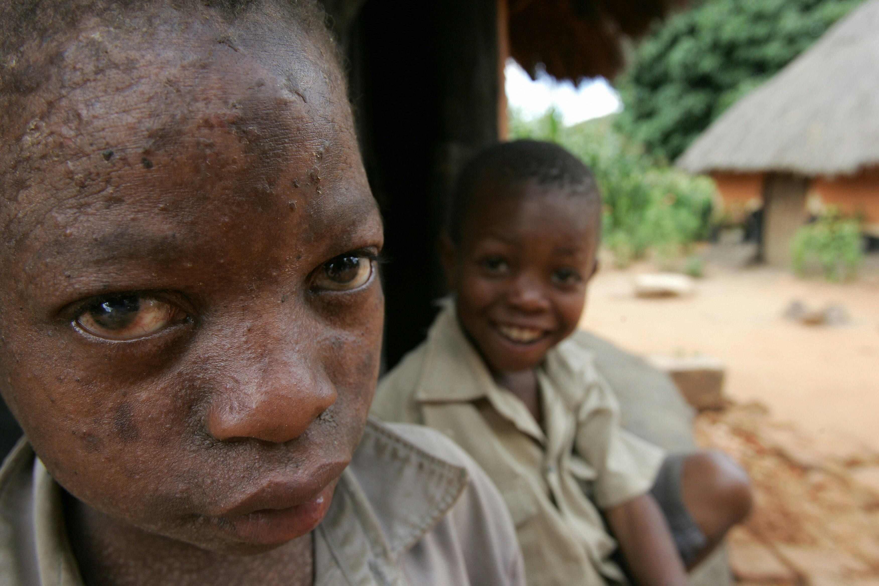 11 Photos That Show the Real Issues Facing Zimbabwe