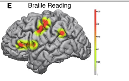 Brain Scans Reveal the Way Blind People See Isn't That Different From ...