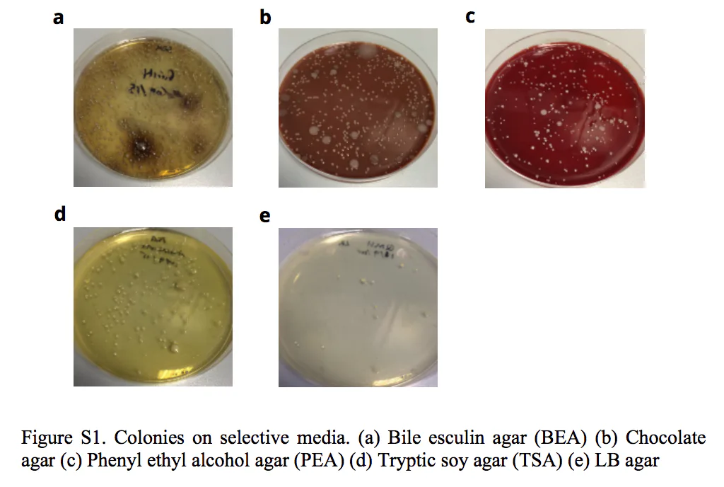 Cash is even grosser than you knew: Dangerous bacteria survive on paper ...