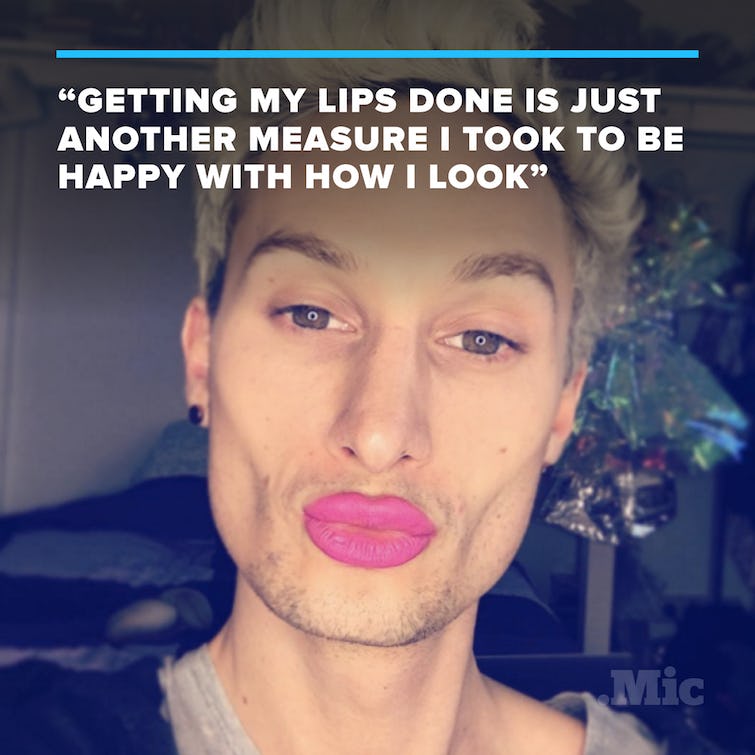 Why Lip Enhancement Is the Hottest Plastic Surgery Trend — Especially ...